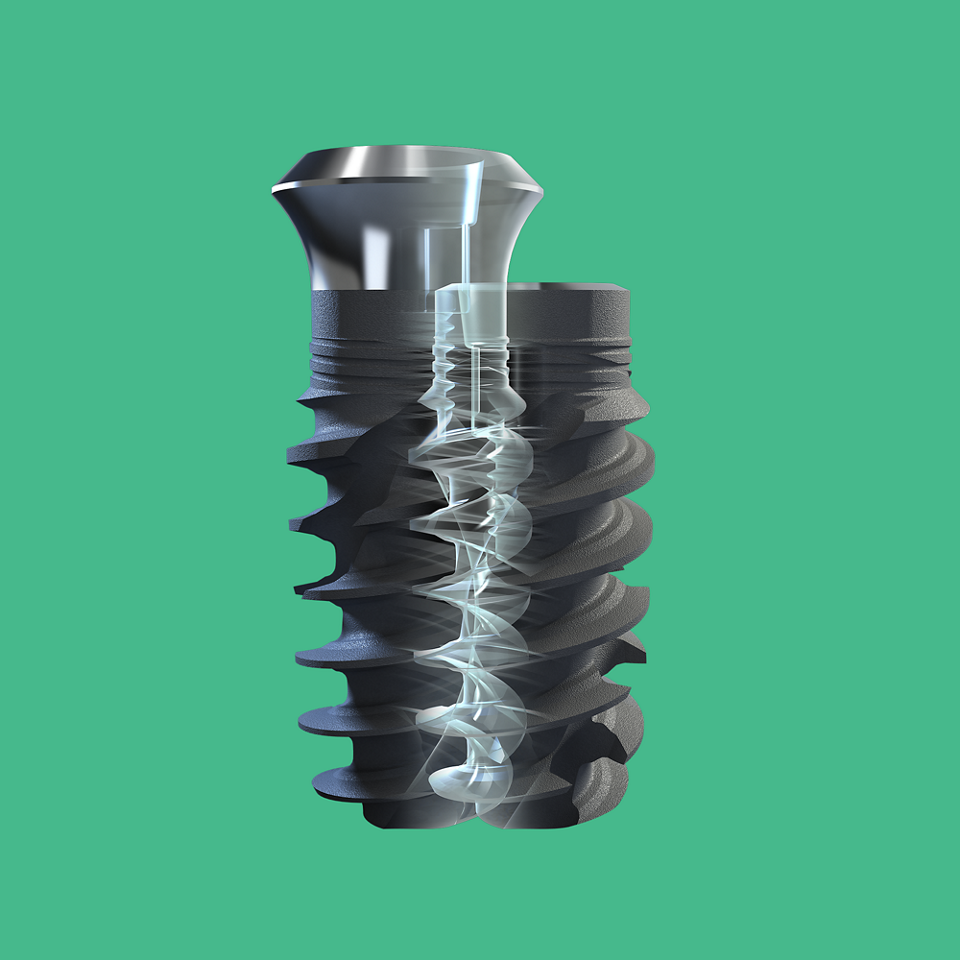 Immediate placement: Save time and preserve precious tissues